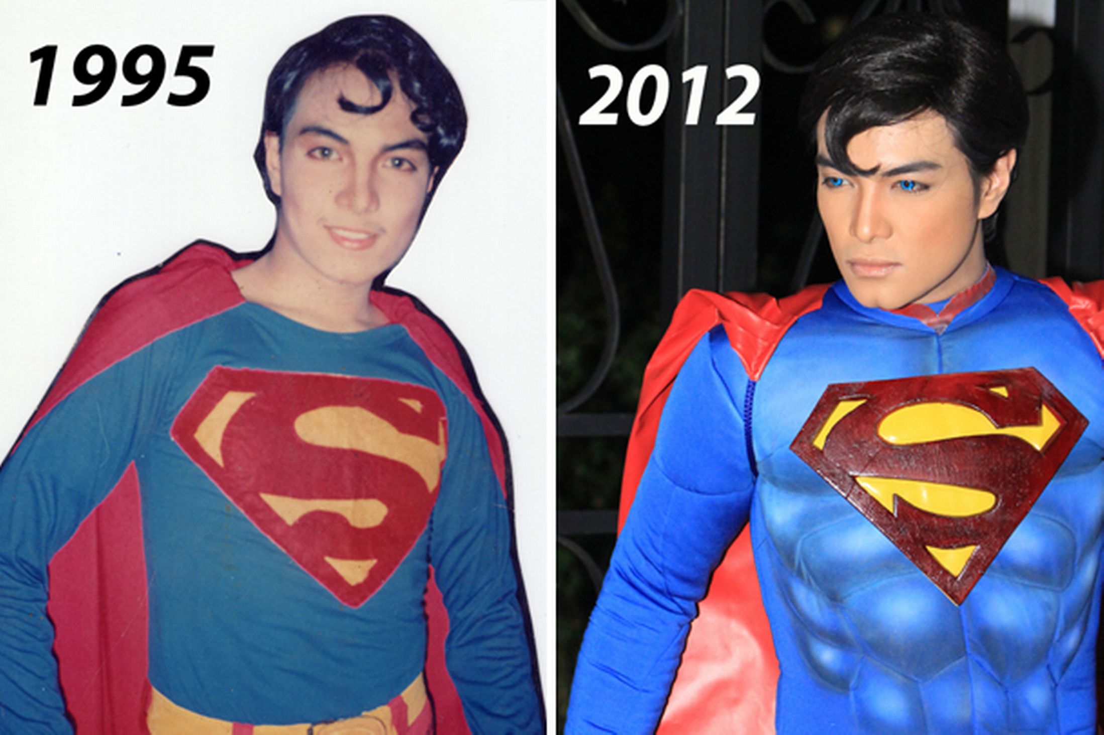 Herbert Chavez - Superman - Surgery - Before and After - Lazer Horse